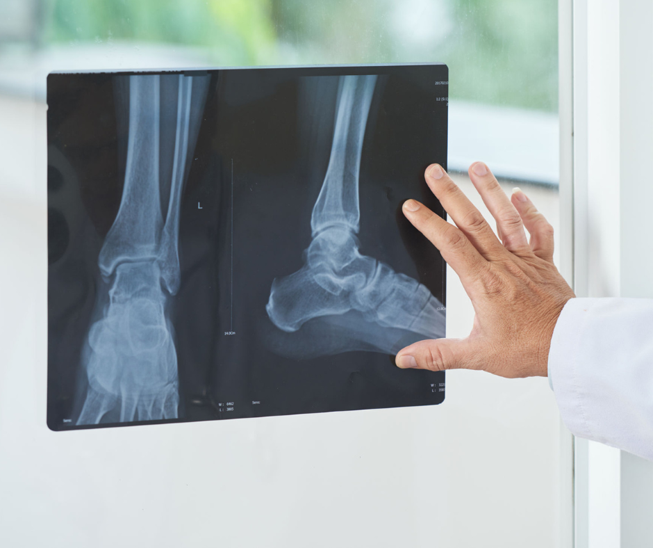 5 Reasons Your Feet Might Need a Closer Look Under the X-Ray - My ...